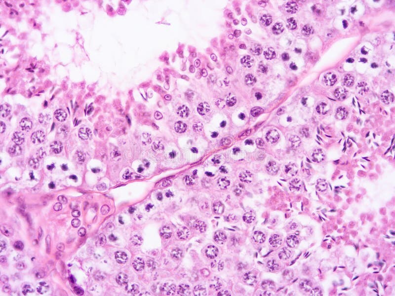 Histology of Testis Human Tissue Stock Image - Image of research ...