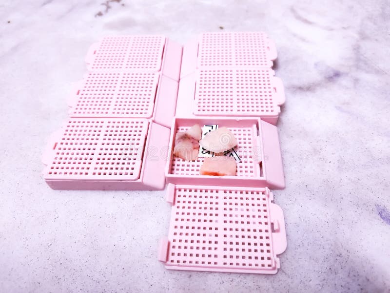 Histology Tissue Processing Embedding Cassettes. Stock Image - Image of ...