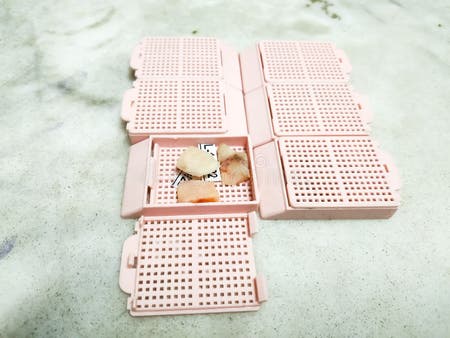 Histology Tissue Processing Embedding Cassettes. Stock Photo - Image of ...