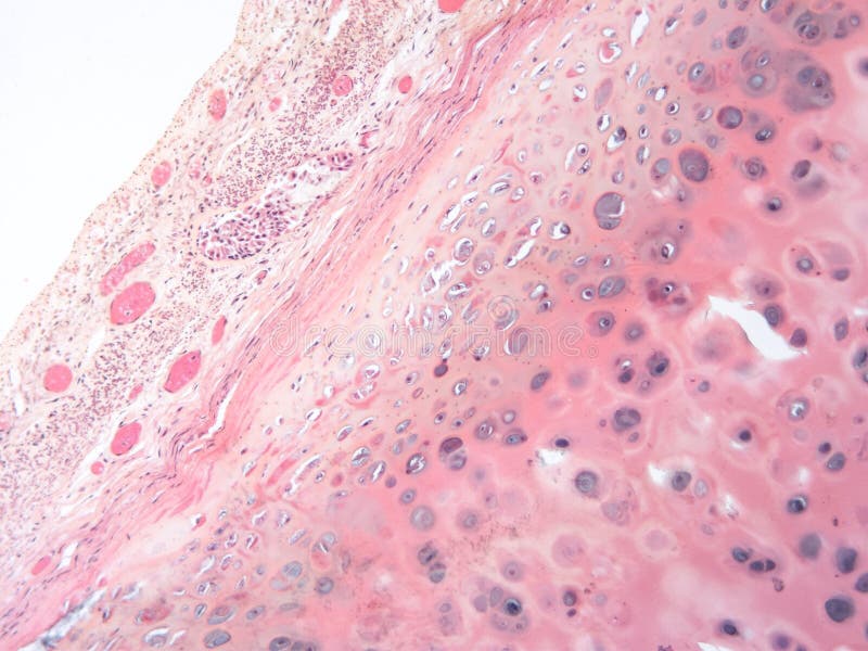 Histology of Trachea Human Tissue Stock Image - Image of squamous ...