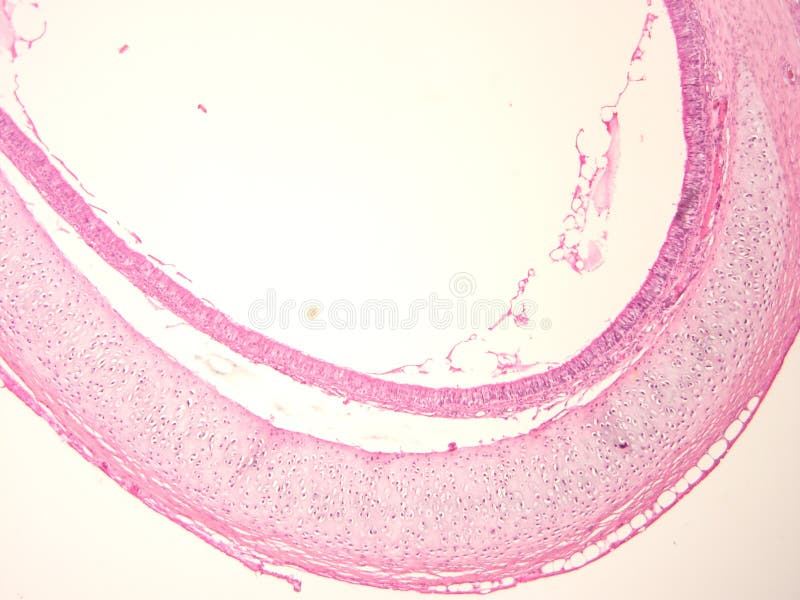 Histology of Trachea Human Tissue Stock Image - Image of health, muscle ...