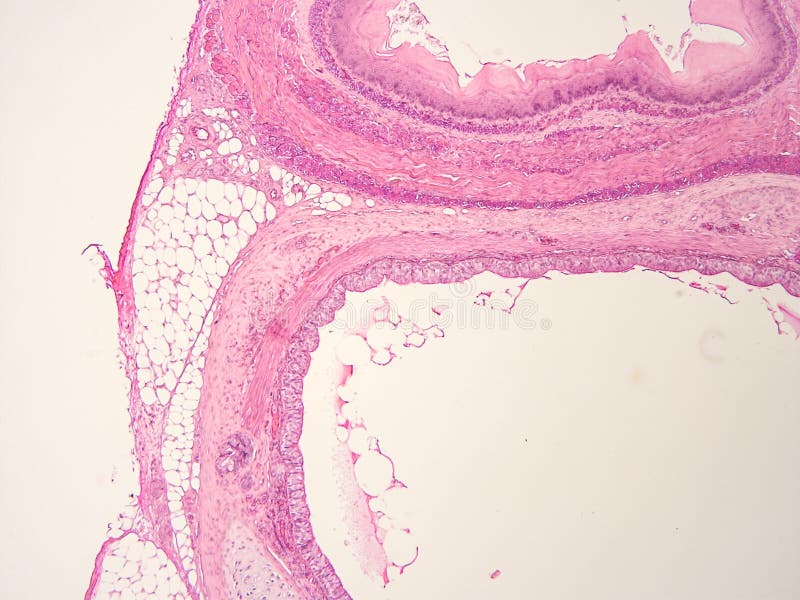 Histology of Trachea Human Tissue Stock Image - Image of gland, human ...