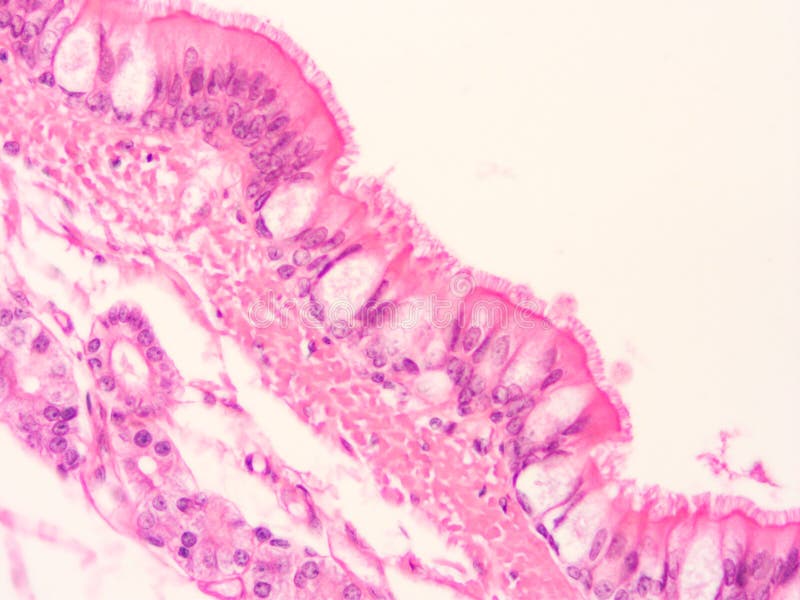 Histology of Trachea Human Tissue Stock Photo - Image of microscopic ...