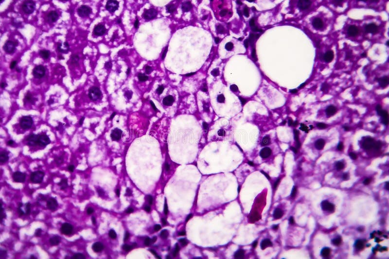 409 Microscope Hepatitis Stock Photos - Free & Royalty-Free Stock ...