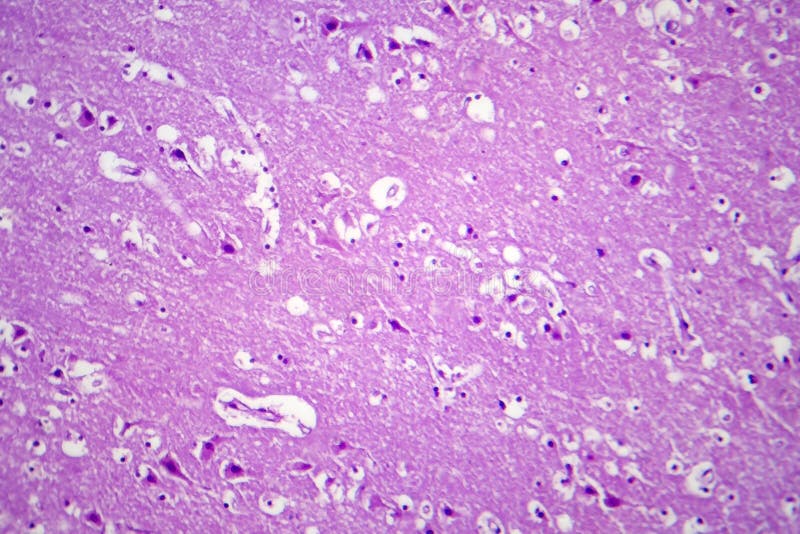 Insect Histology Stock Photos - Free & Royalty-Free Stock Photos from ...