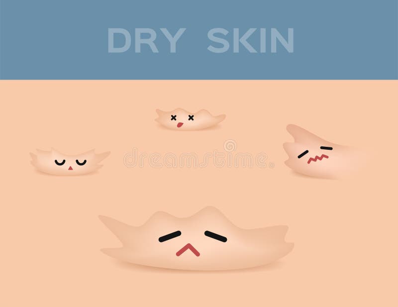 Historieta de la piel seca ilustración del vector. Ilustración de salud ...