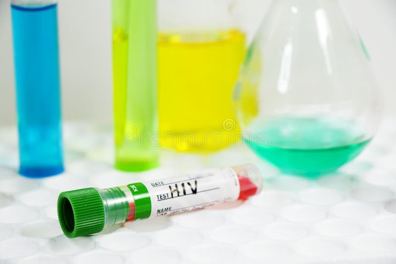 HIV Blood Test Tube Sample, Aids and Immune Viruses Stock Image - Image ...