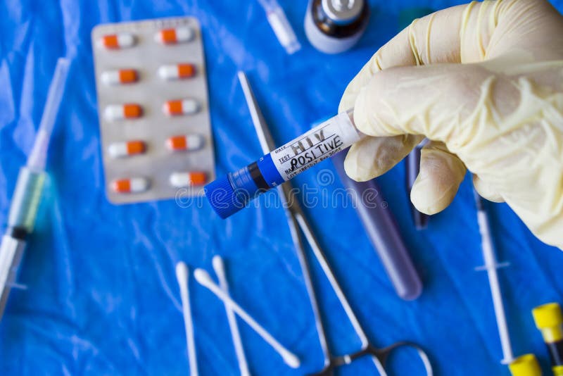 HIV Blood Test Tube Sample, Aids and Immune Viruses Stock Photo - Image ...