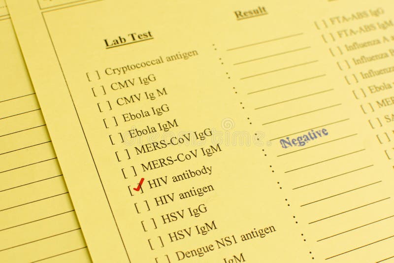 HIV negative stock image. Image of immunology, patient - 56238945