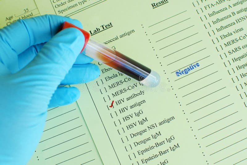 HIV negative stock photo. Image of negative, infection - 56238996