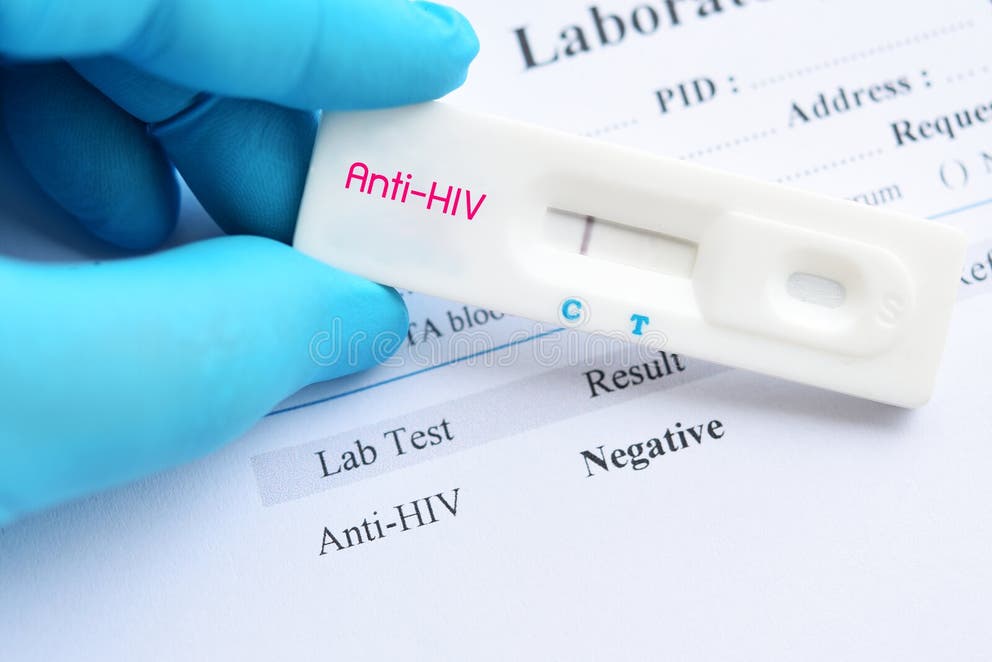 HIV negative test result stock image. Image of diagnosis - 121584765