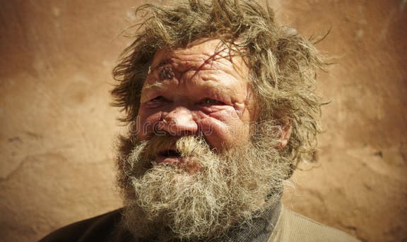 Hobo stock image. Image of beard, face, person, beggar - 11230355