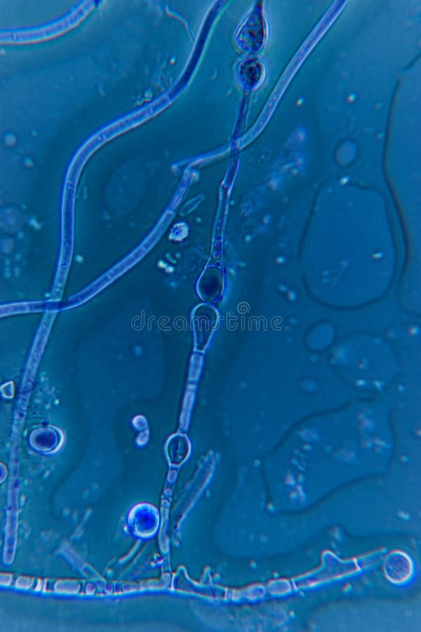 Hojas Putrefactas En El Microscopio Foto de archivo - Imagen de ...