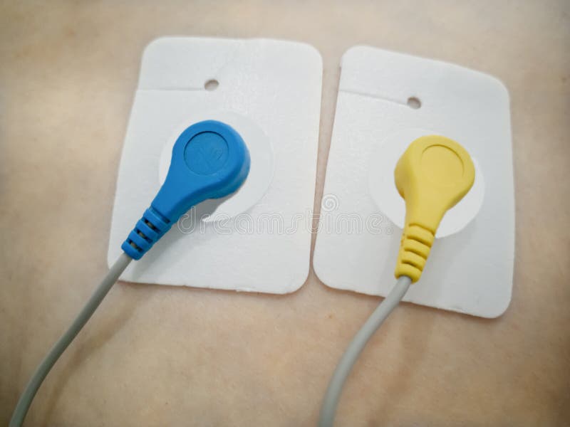 Holter Monitoring. 24-hour ECG Recording Stock Photo - Image of ... Holter Monitoring. 24-hour ECG Recording Stock Photo - Image of ...