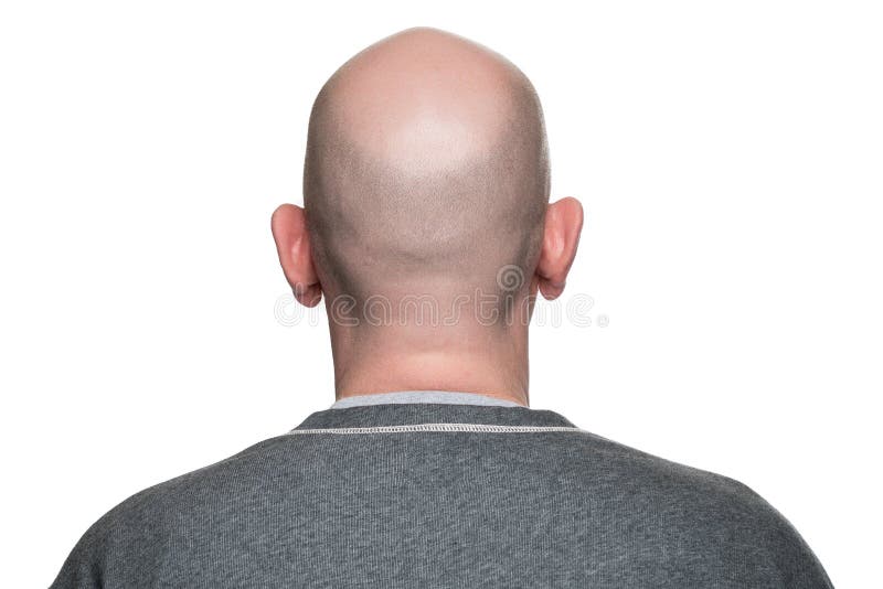 Vista Posterior Adulta De La Cabeza Calva Del Hombre Imagen de archivo ...