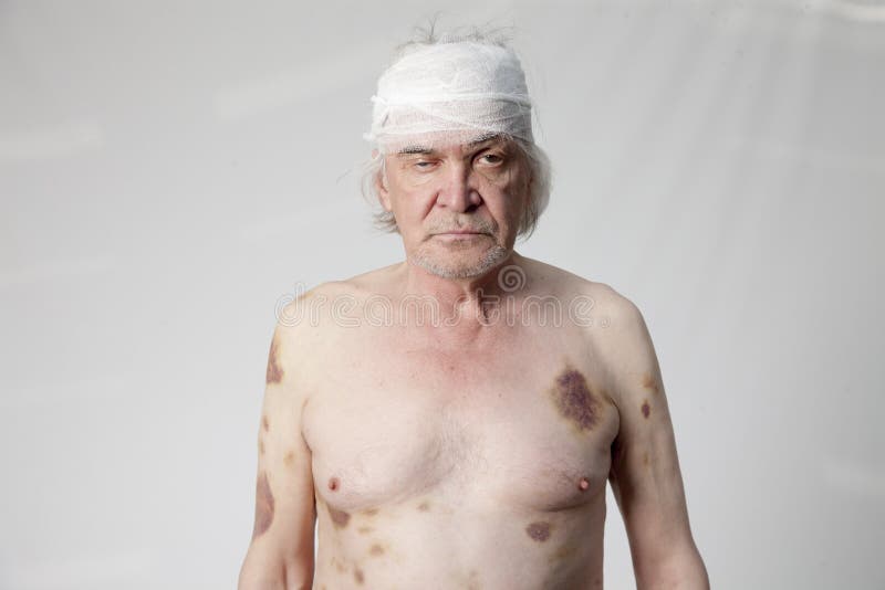 410 Hombre Mutilado Bandidos Fotos de stock - Fotos libres de regalías ...