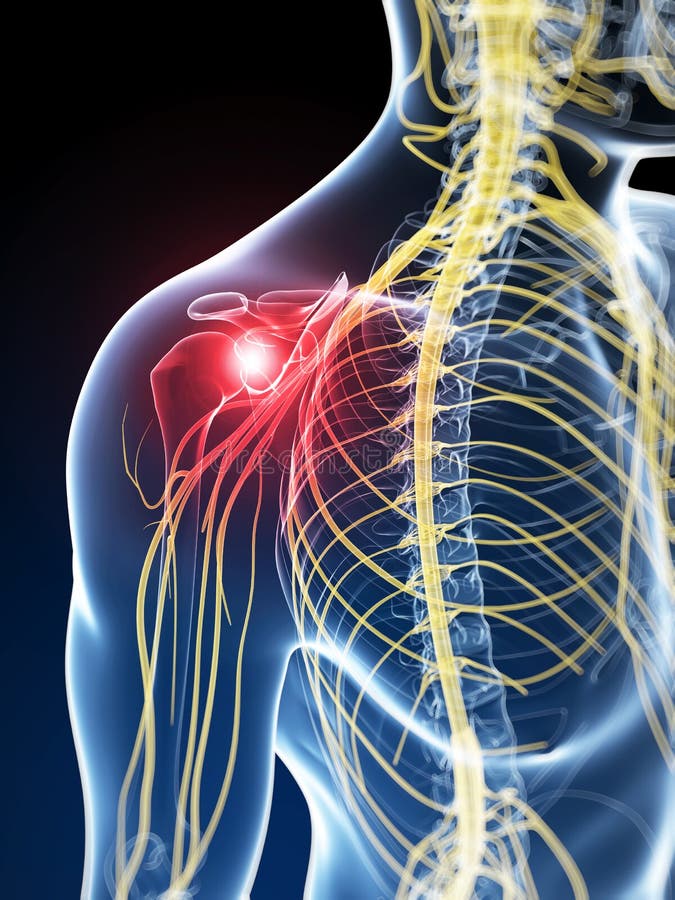 Nervios del hombro stock de ilustración. Ilustración de lesión - 30721780