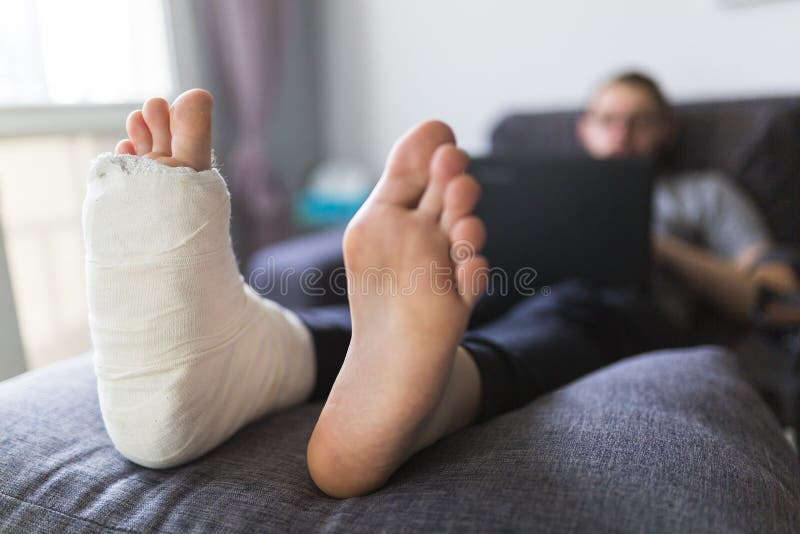 Home Convalescence after Breaking the Right Leg Stock Image - Image of ...