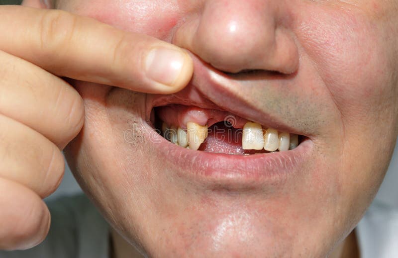 Dentista Que Mostra Ao Paciente Do Homem Como Limpar Os Dentes Imagem ...