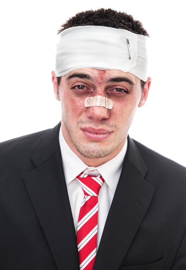 Homme battu d'affaires photo stock. Image du meurtri - 28820702