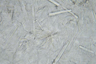 Honey with Large Rectangular Sugar Crystals Under Microscope Stock ...