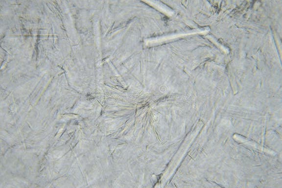 Honey with Large Rectangular Sugar Crystals Under Microscope Stock ...