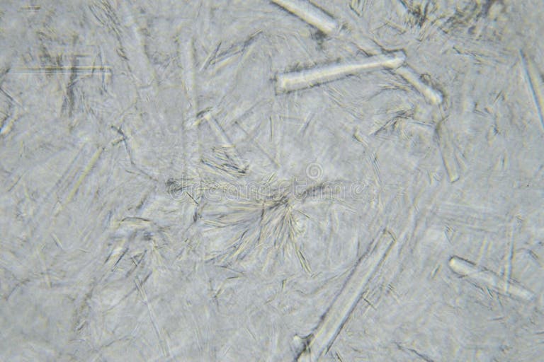 Honey with Large Rectangular Sugar Crystals Under Microscope Stock ...