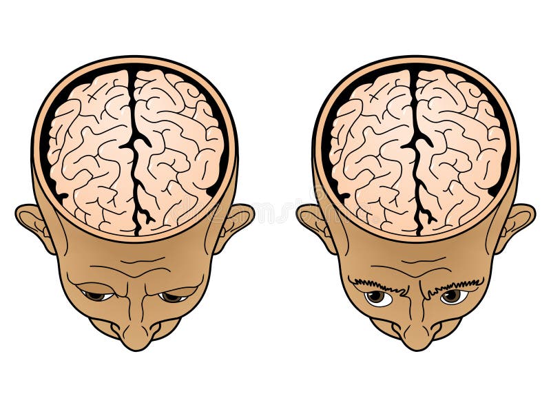 Hoofd Van Een Man Met Een Openstaande Afbeelding Van Het ...