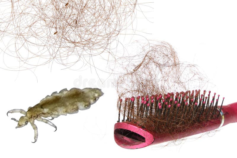 Hoofdluizen (luis) stock foto. Image of sluit, weinig - 57124698