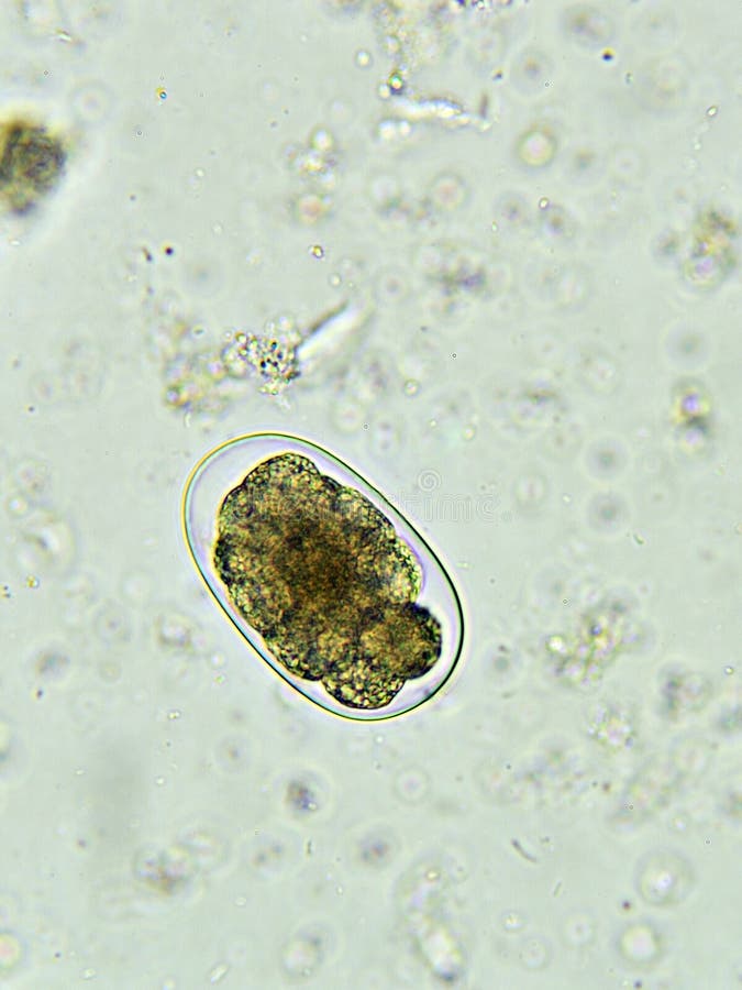 Helminth eggs stock image. Image of hookworm, diminuta - 70356359