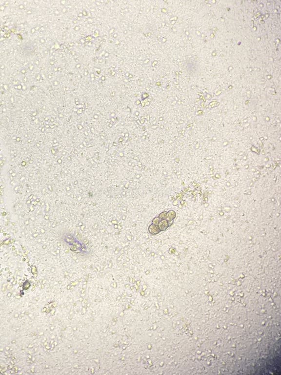 Hook Worm Eggs of Parasite in Stool Examination Stock Image - Image of ...