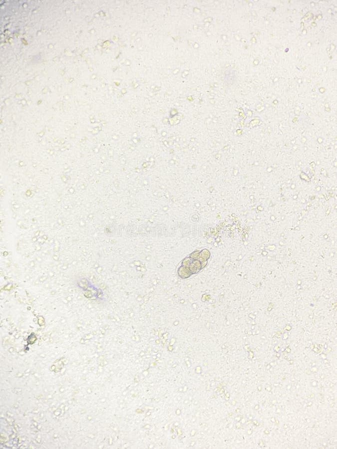 Hook Worm Eggs of Parasite in Stool Examination Stock Image - Image of ...