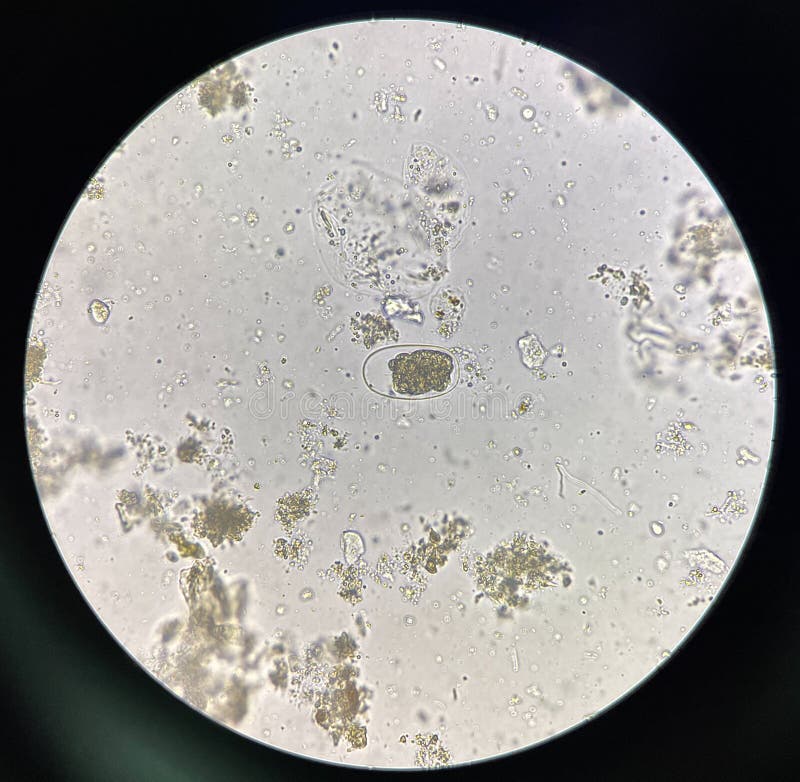 Hookworm Egg Human Parasite in Stool Examination Test Stock Photo ...