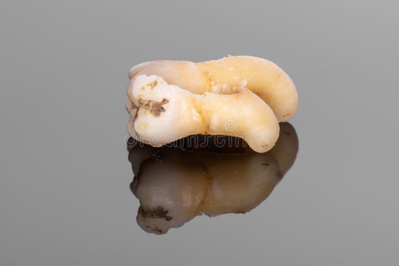 A Closeup of a Sectioning Right Lower Third Molar with Curved Root ...