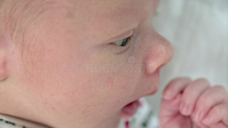Hormonal Rashes in Newborns Nose Hand Stock Video - Video of eyes ...