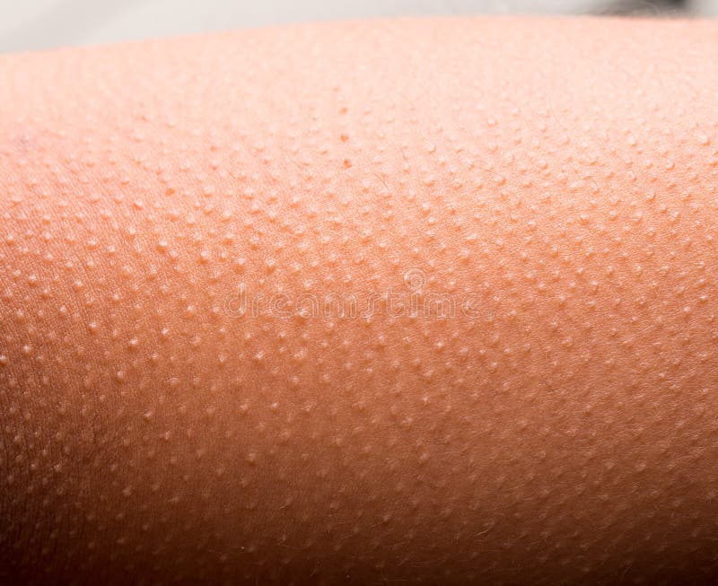 Goosebumps Skin Background stock photo. Image of goosebump - 6112842