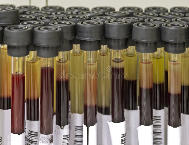 Hospital blood test tubes stock image. Image of healthcare - 20189649