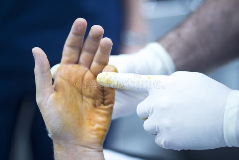 Hospital Hand Surgery Orthopedics Operation Stock Photo - Image of ...