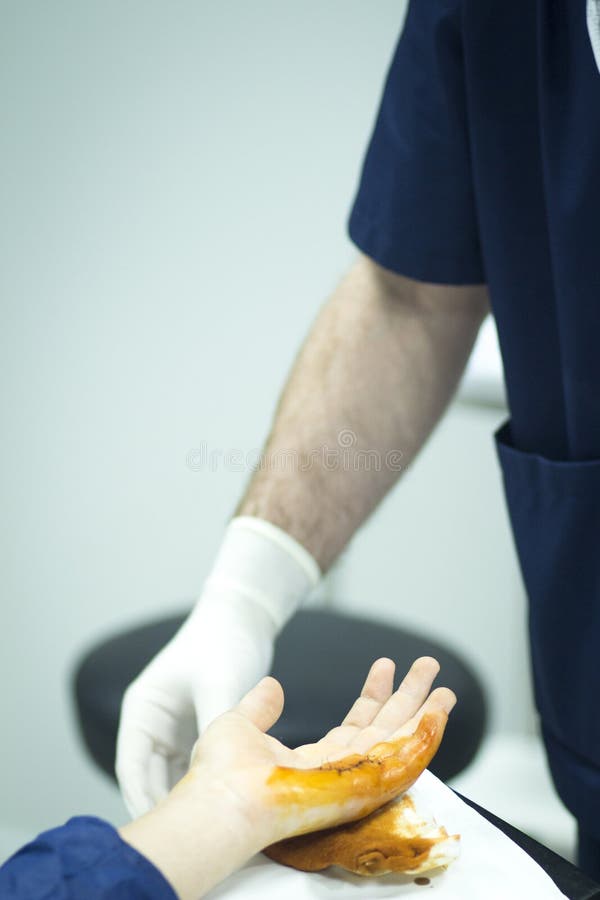 Hospital Hand Surgery Orthopedics Operation Stock Image - Image of ...