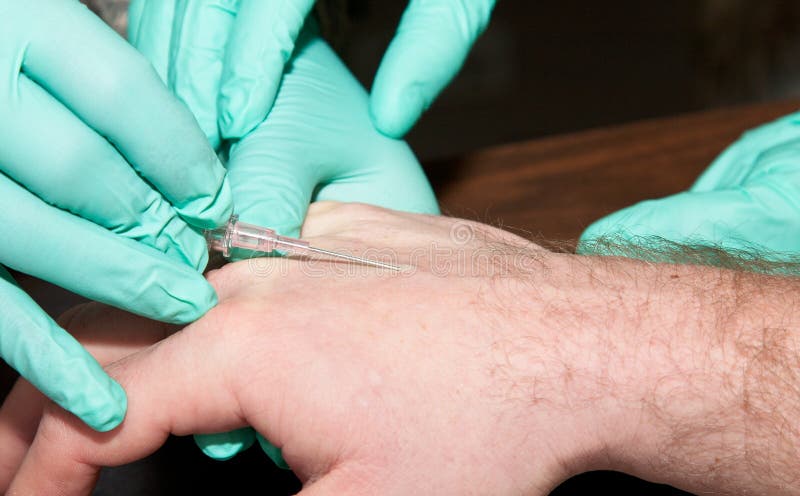 At the Hospital: Insertion of an IV Stock Photo - Image of cure, drip ...