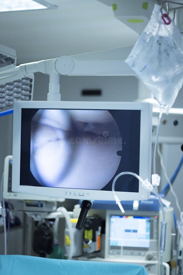 Hospital Surgery Arthroscopy Operation Screen Stock Image - Image of ...