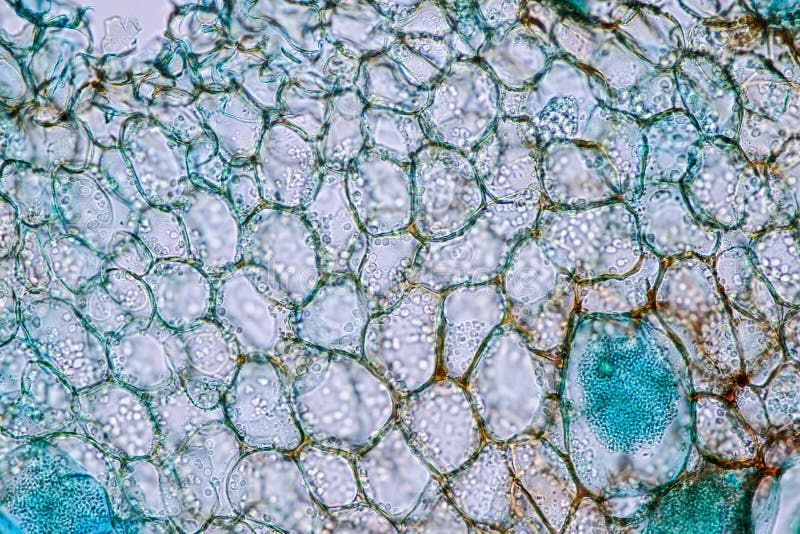 Host Cells with Spores Mold are Inside Wood Under the Microscope Stock ...