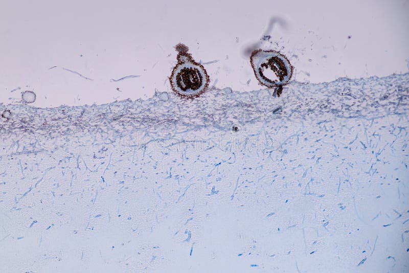 Host Cells with Spores Mold are Inside Wood Under the Microscope Stock ...