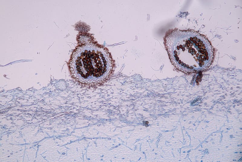 Host Cells with Spores Mold are Inside Wood Under the Microscope Stock ...
