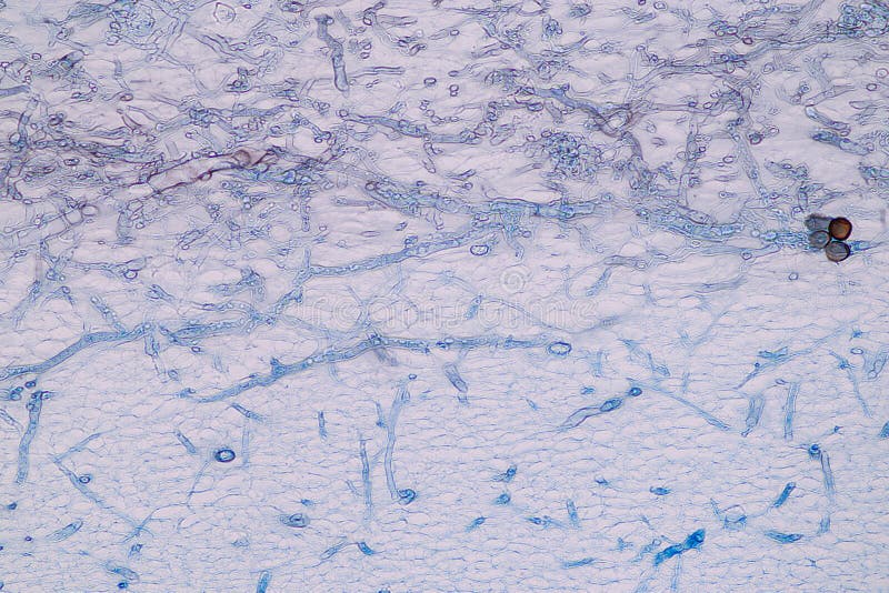 Host Cells with Spores Mold are Inside Wood Under the Microscope ...