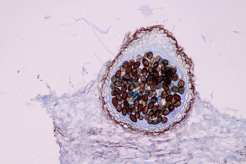 Host Cells with Spores Mold are Inside Wood Under the Microscope Stock ...