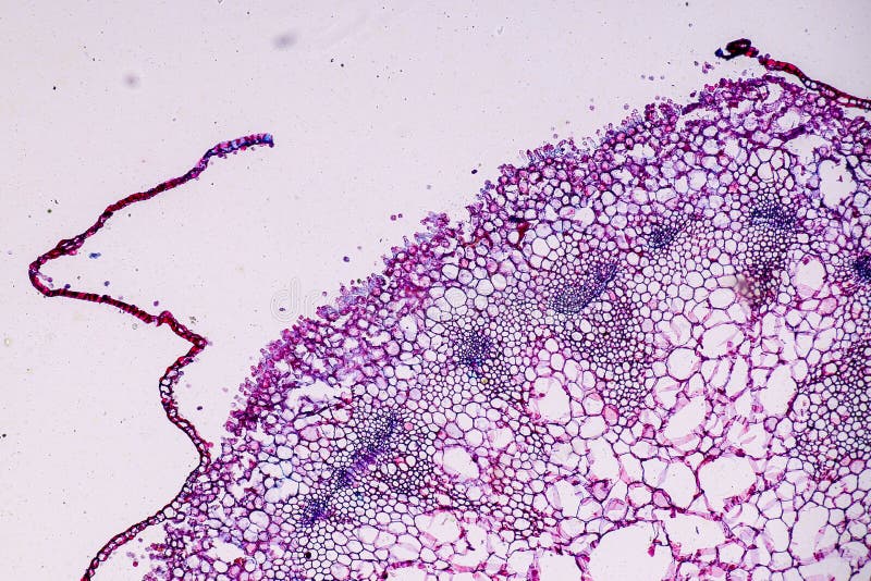 Host Cells with Spores Mold are Inside Wood Under the Microscope Stock ...