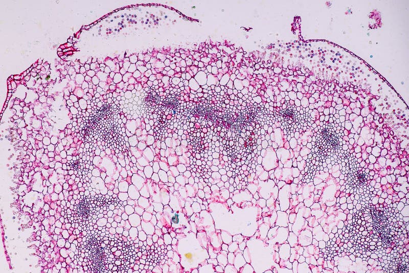 Host Cells with Spores Mold are Inside Wood Under the Microscope Stock ...