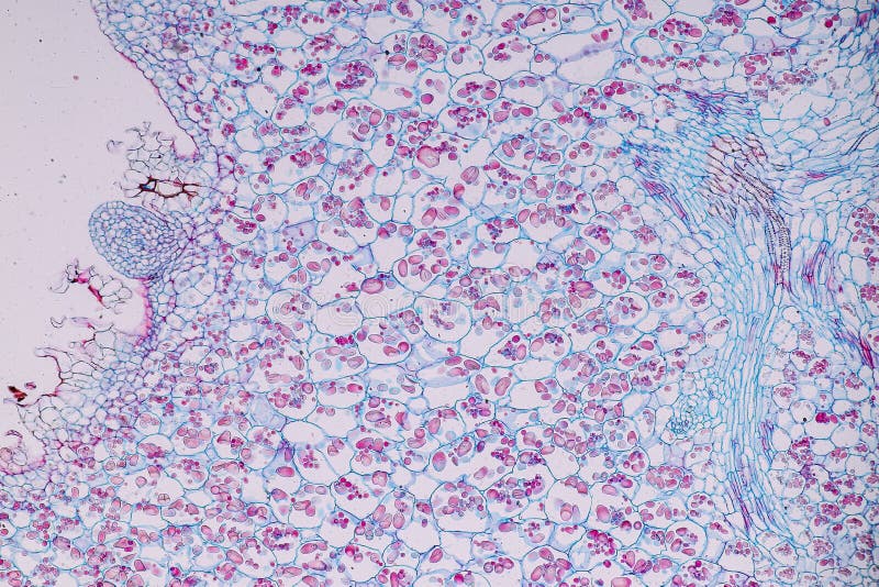 Host Cells with Spores Mold are Inside Wood Under the Microscope. Stock ...