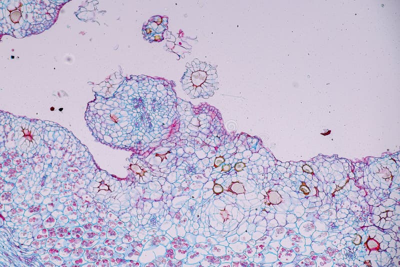 Host Cells with Spores Mold are Inside Wood Under the Microscope. Stock ...